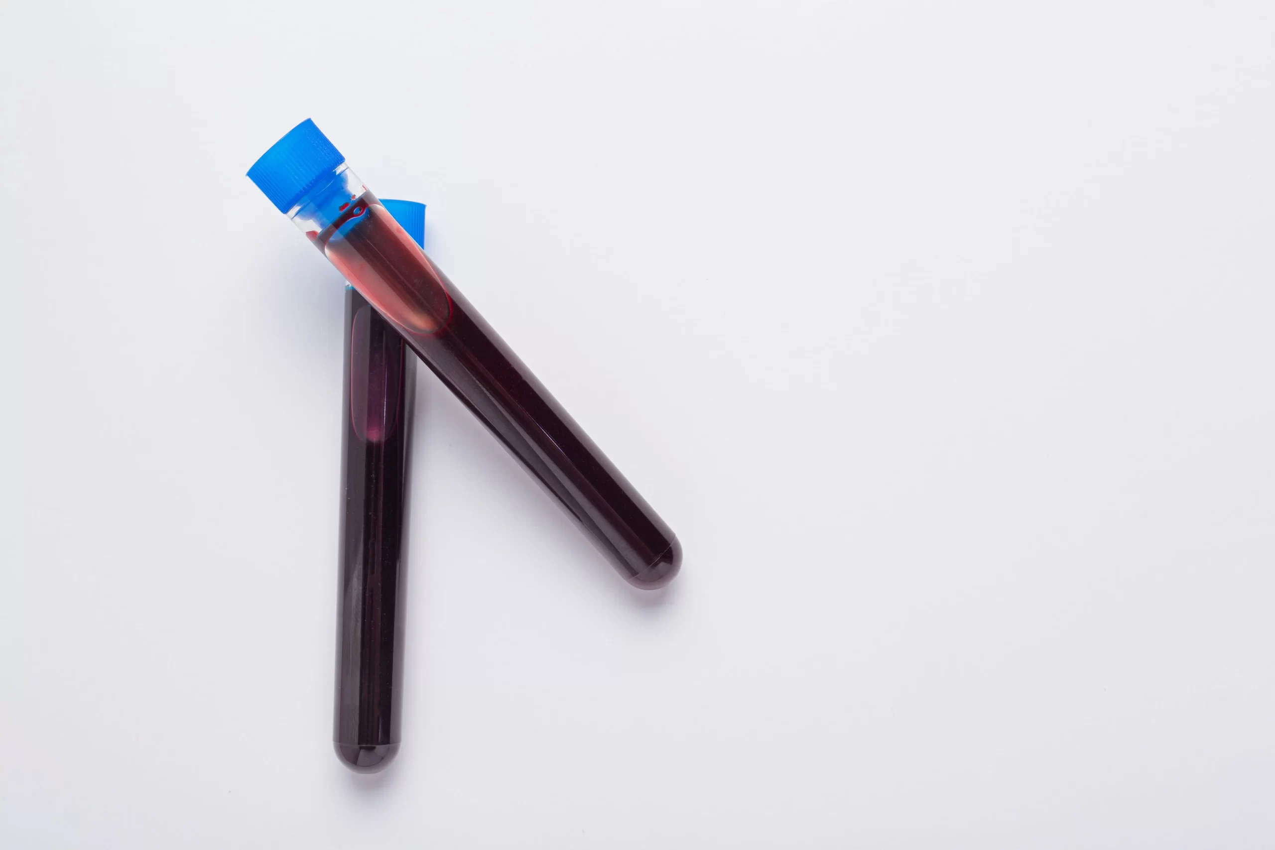Analysis of serum protein levels in the blood - ANNVIO